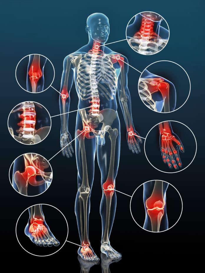 Book Review: Body On Fire, Anti-Inflammatory Cookbook - WorldHealth.net