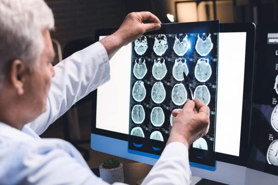 What Happens When the Brain Lacks Oxygen? - WorldHealth.net