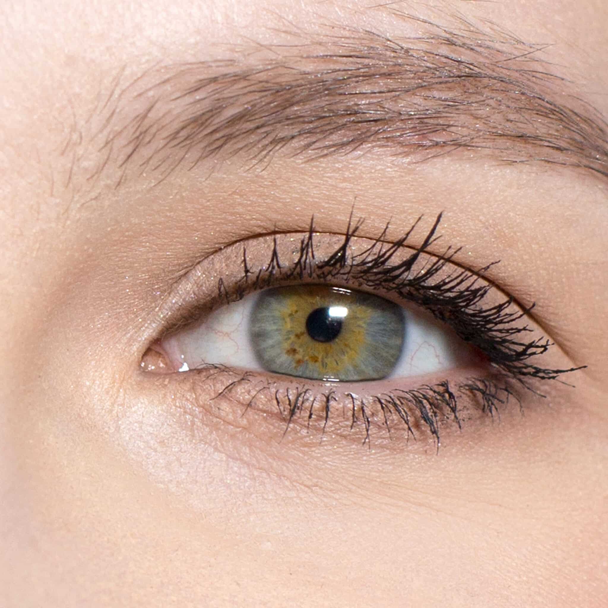 Central Heterochromia: Why Your Eyes Might be Two Colors