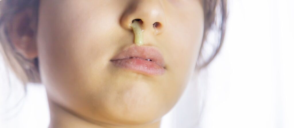 Is Green Mucus an Infection? A Guide to Color and Thickness